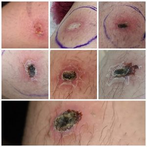 11 Arizona Bugs That Bite And Sting In 2025