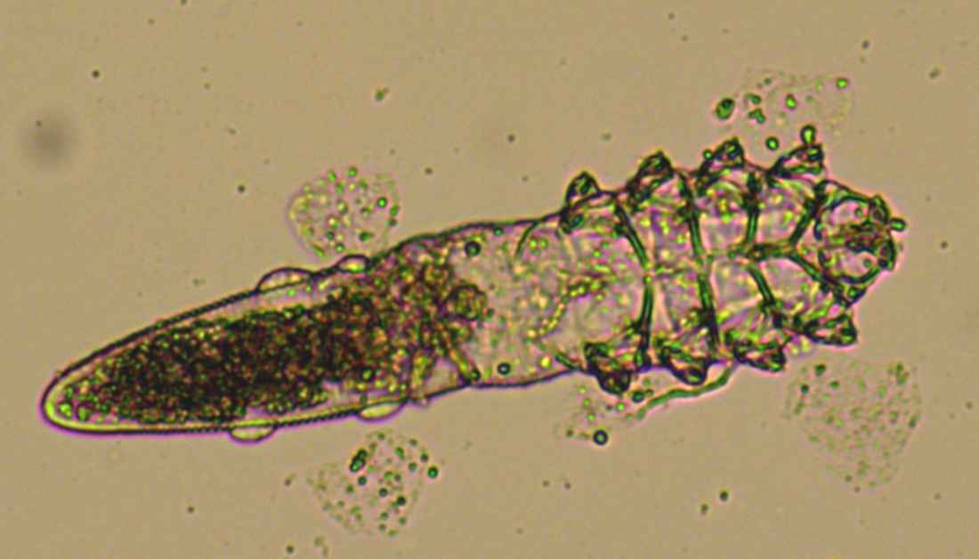 16 Mysterious Microscopic Bugs That Bite (And Easy Solutions)