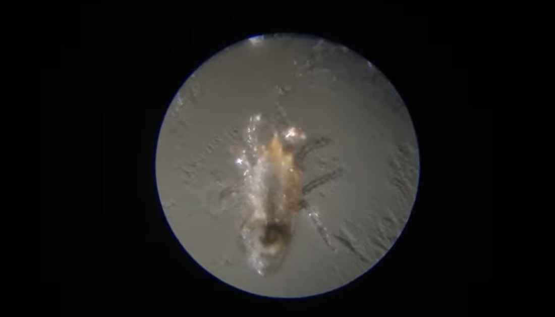 16 Mysterious Microscopic Bugs That Bite (And Easy Solutions)