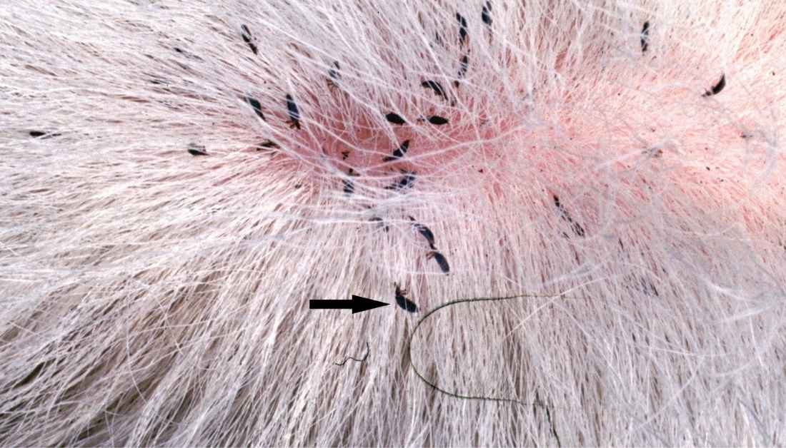 7 Tiny Black Bugs On Dogs (No, These Are NOT Fleas)